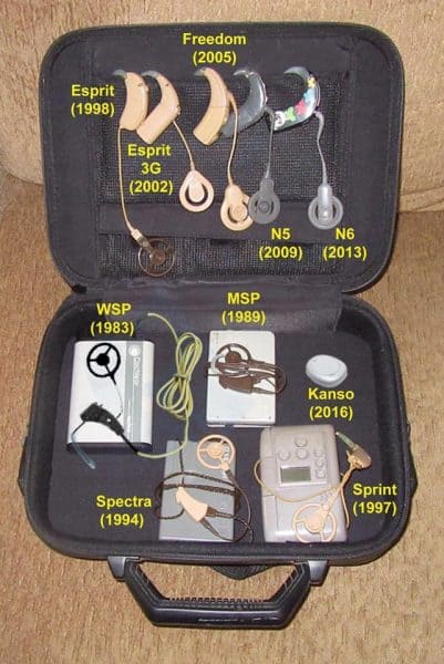 Early cochlear implant adopter on hearing with advanced technology