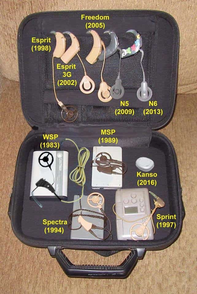 Early cochlear implant adopter on hearing with advanced technology