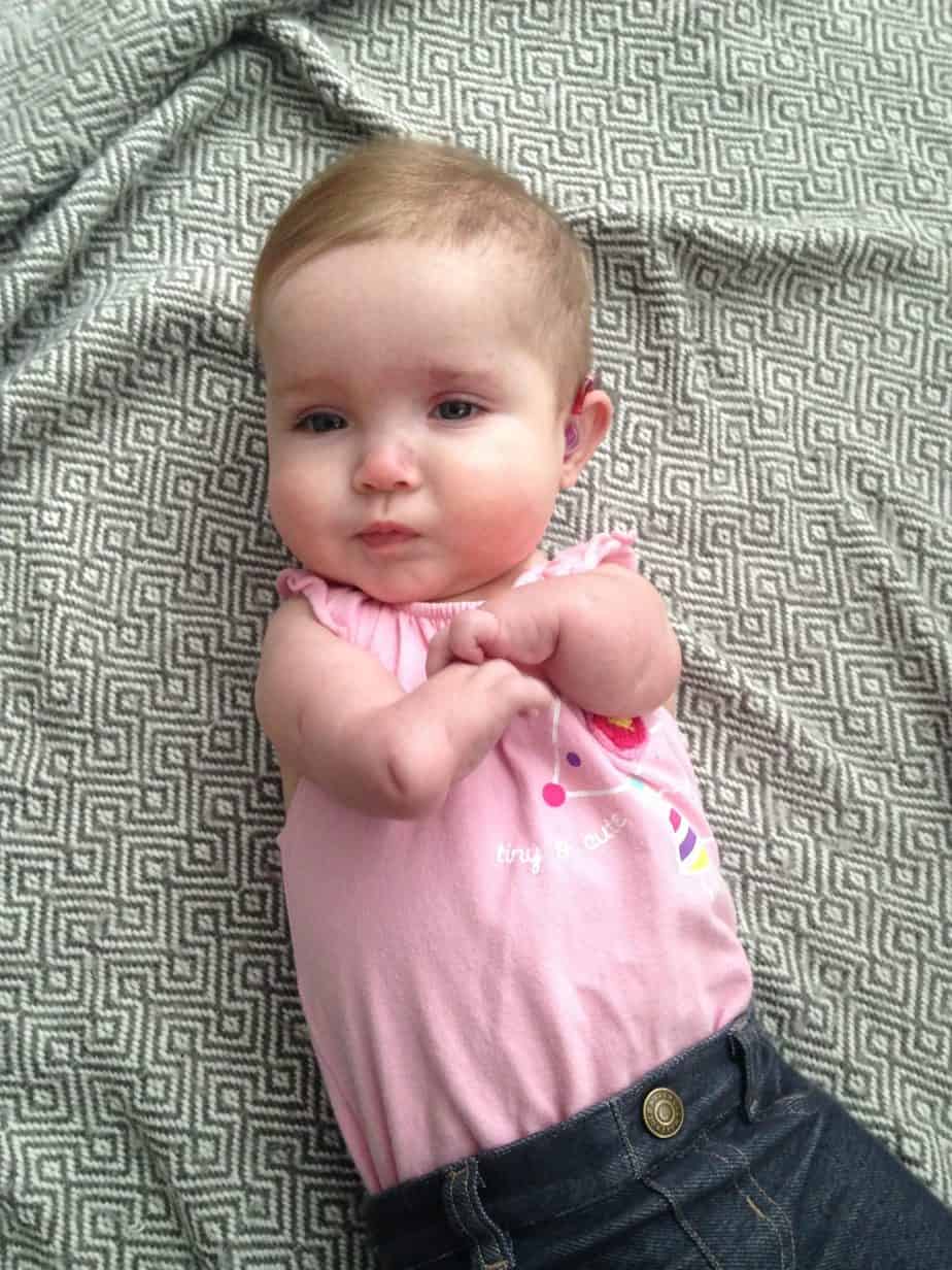Unable To Sign Little Girl Born Deaf Gets Cochlear Implants To Communicate
