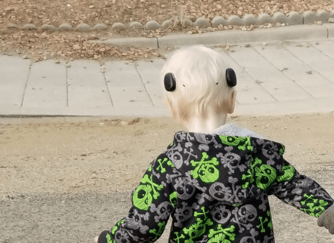 Cochlear’s off-the-ear processors are solution for little boy
