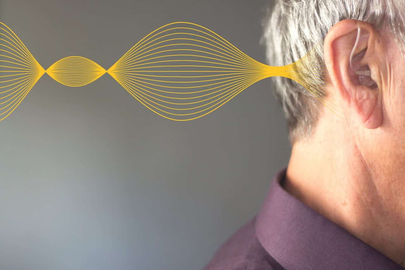 How bone conduction implant systems differ from traditional hearing aids