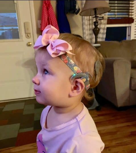 Child with profound hearing loss gets cochlear implants and joy from ...