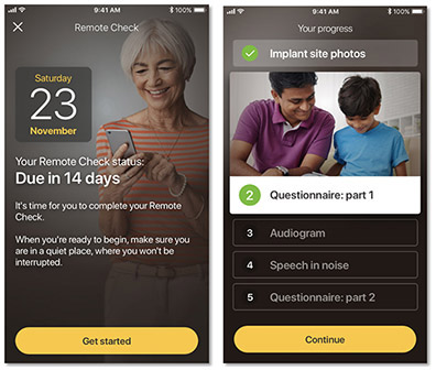 FDA expedites approval of Cochlear’s Remote Check solution