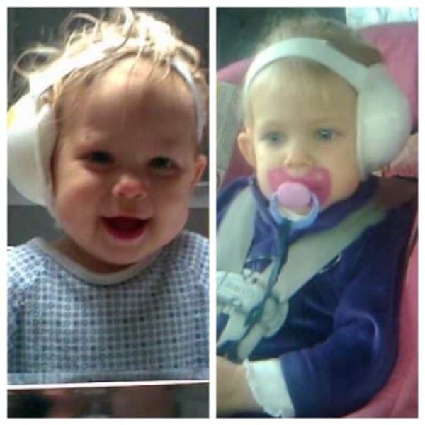 Competitive gymnast hears with cochlear implants after speech therapy