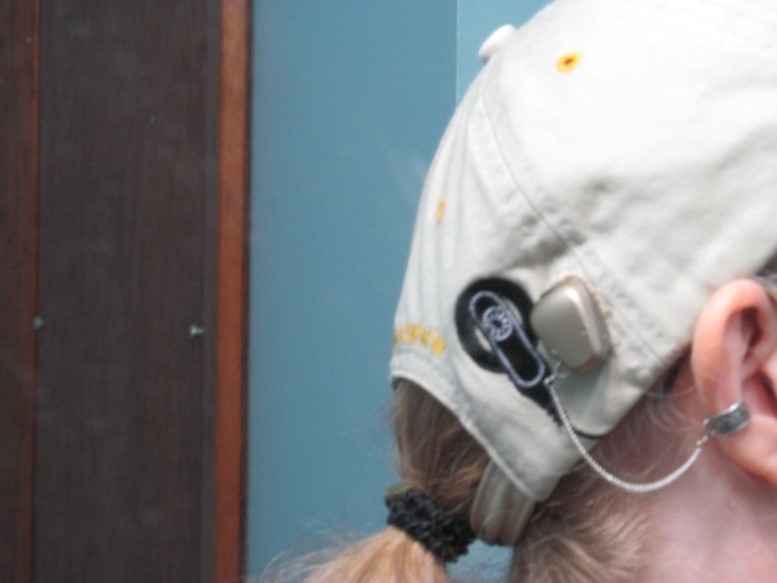 Breast cancer survivor hikes and travels with Baha system