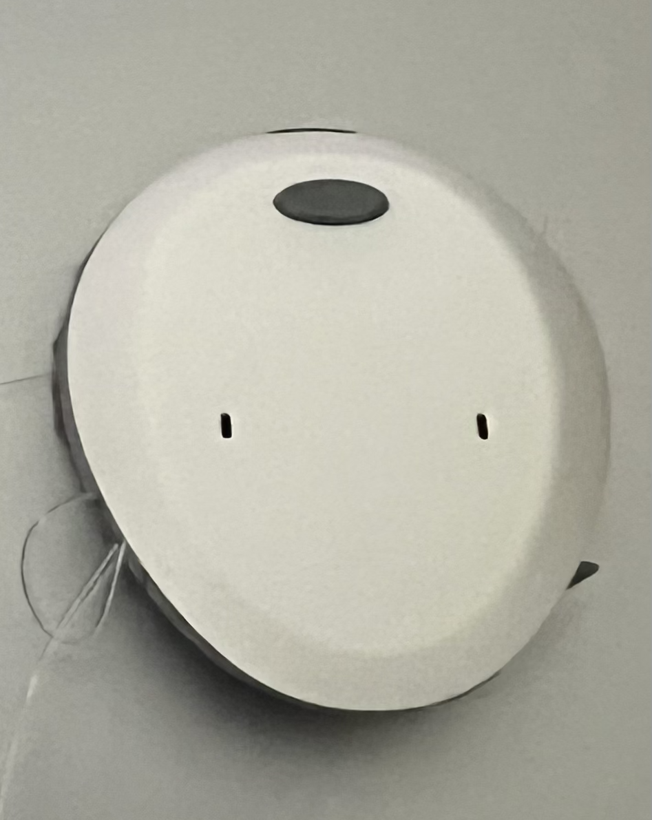 Chad struggled with bilateral conductive hearing loss until the Osia System