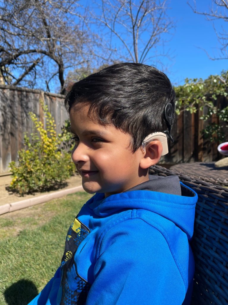 Infant with sensorineural hearing loss enjoys his “super ears”