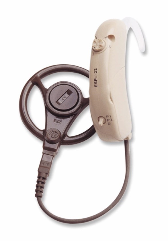 Sound redefined: the Cochlear Nucleus System evolution