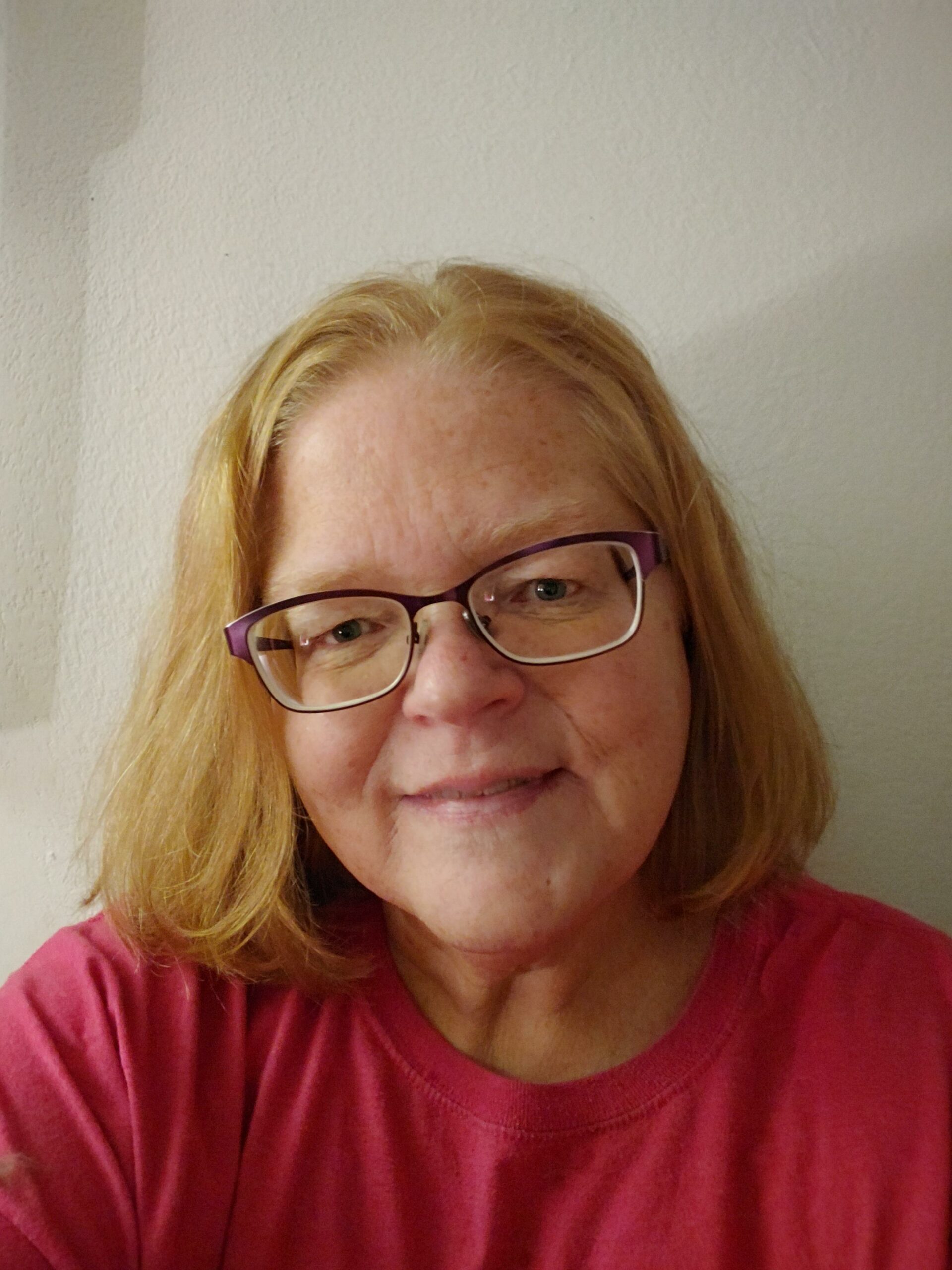 Lisa's cochlear implant helps as a solution to single-sided deafness