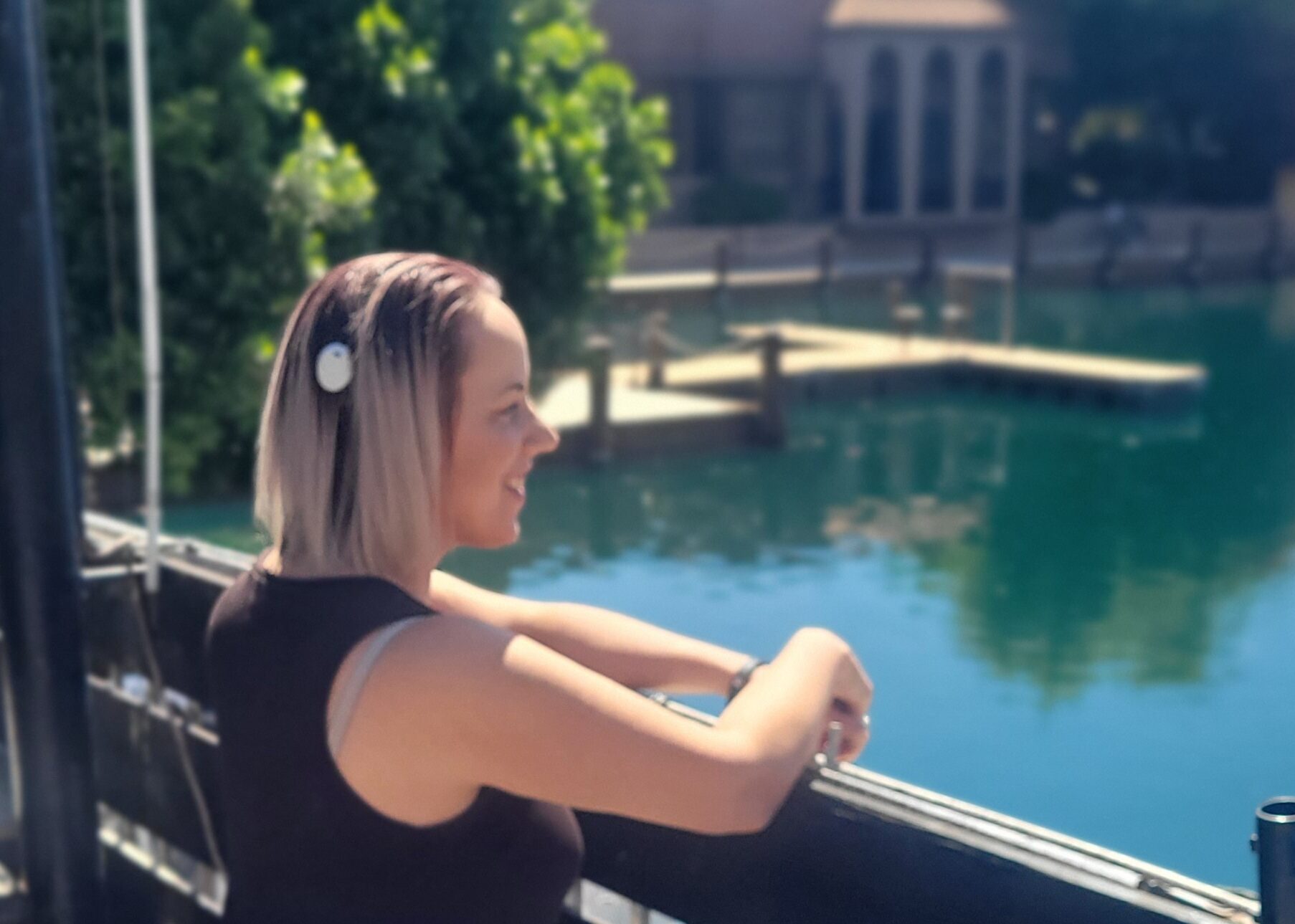 Stephanie cherishes her Cochlear Osia System for SSD