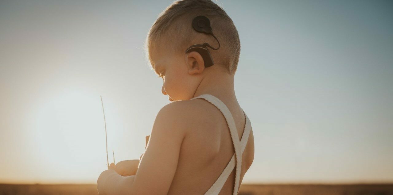 A child with bilateral hearing loss benefits from cochlear implants