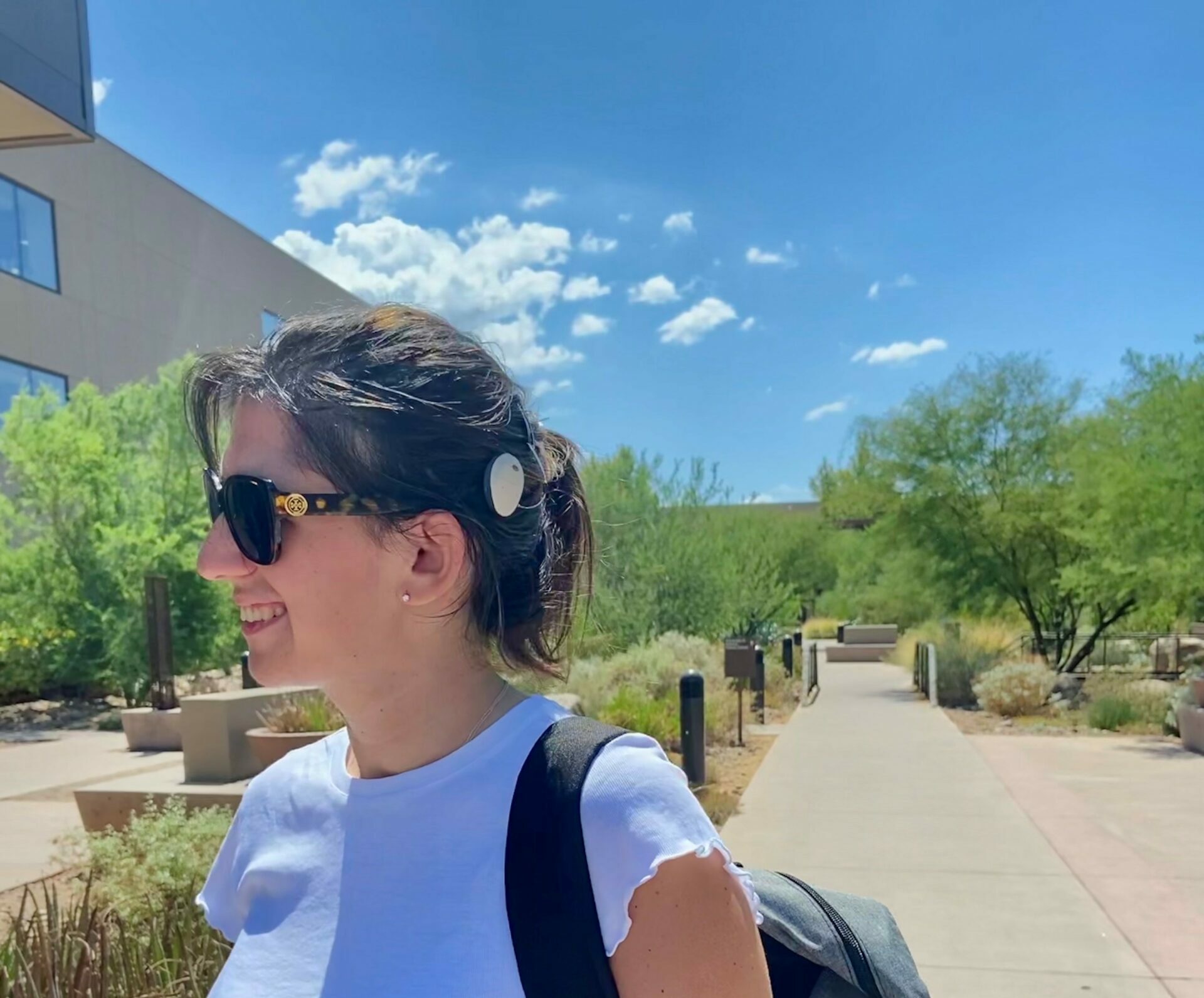 Woman receives hearing clarity from Cochlear’s Osia System