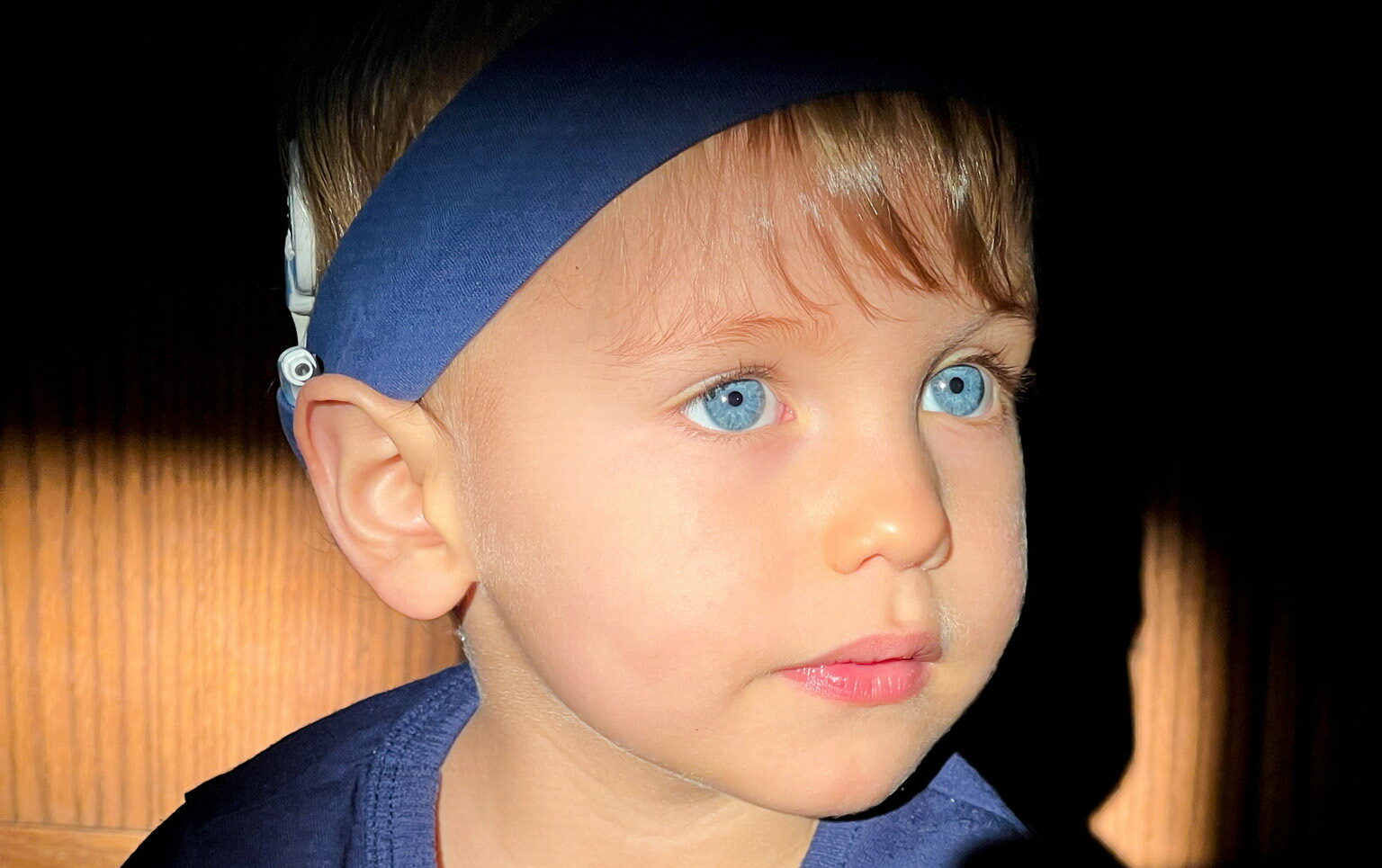 Early intervention with cochlear implants for child's hearing health