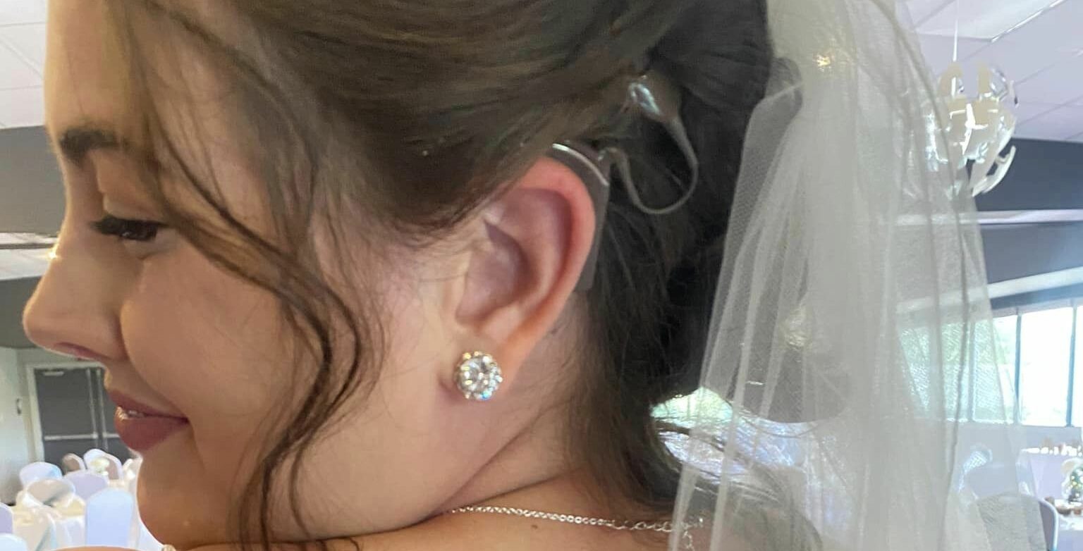 Cochlear implant technology helped Kristina have access to sounds