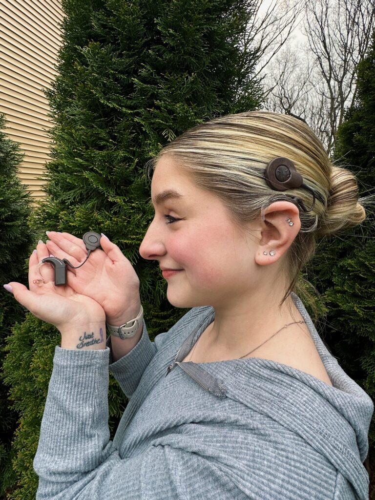 Samantha's transition to bilateral cochlear implants